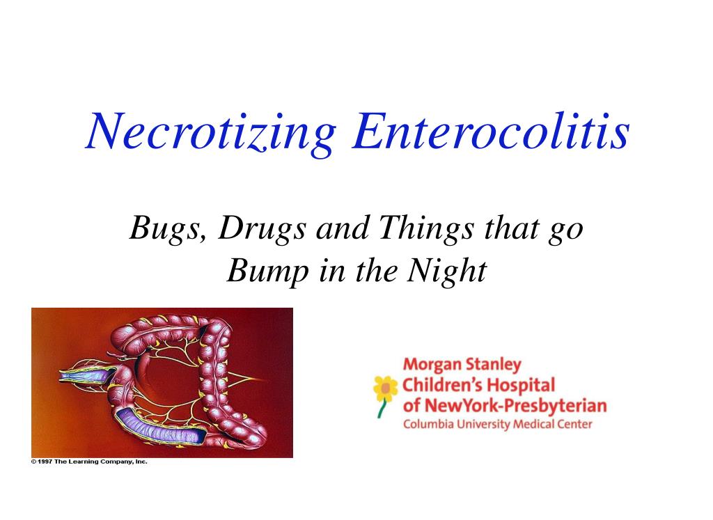 PPT - Necrotizing Enterocolitis PowerPoint Presentation, free download ...