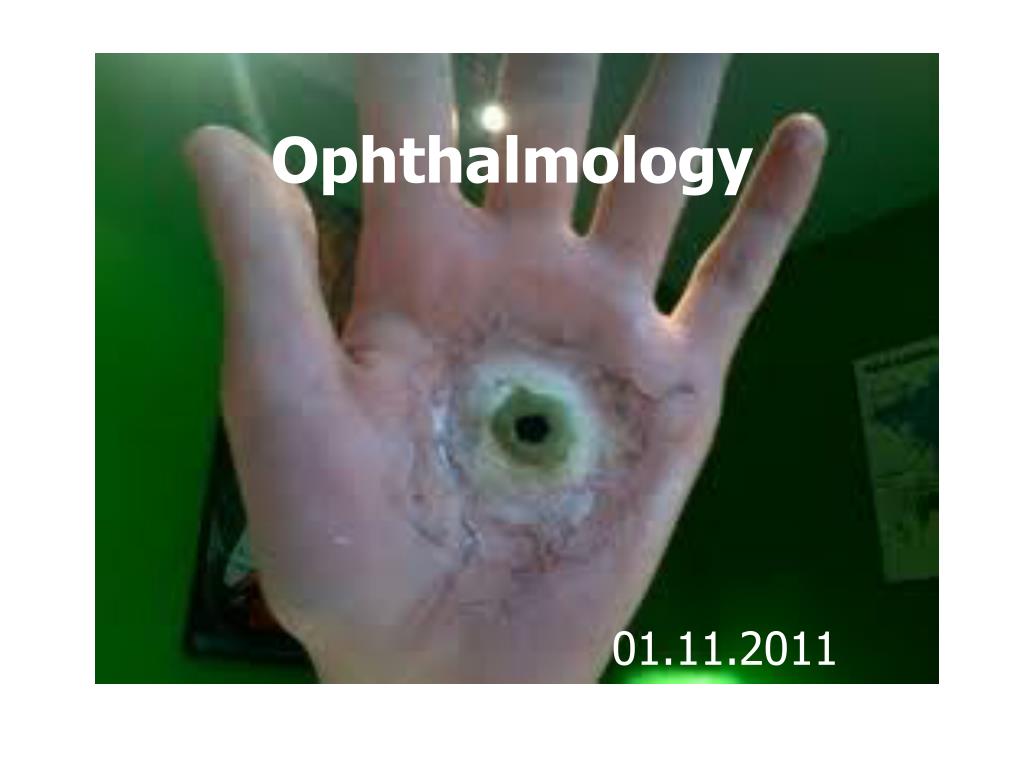 PPT - Ophthalmology PowerPoint Presentation, free download - ID:1035206