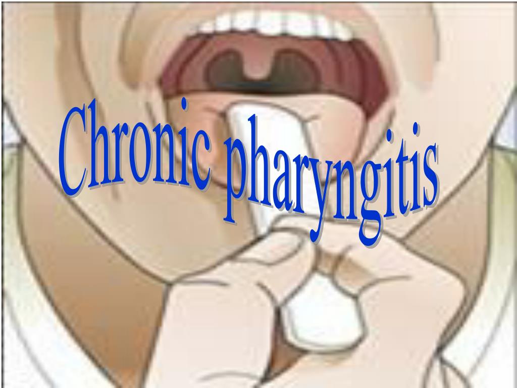 PPT - Chronic pharyngitis PowerPoint Presentation, free download - ID ...