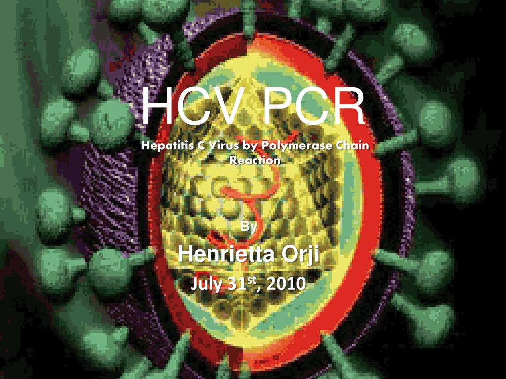 PPT - HCV PCR PowerPoint Presentation, free download - ID:1043119