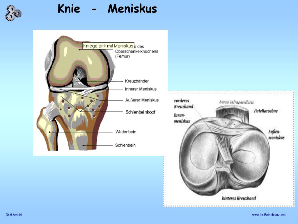 PPT - Knie - Meniskus PowerPoint Presentation, free download - ID:1054748