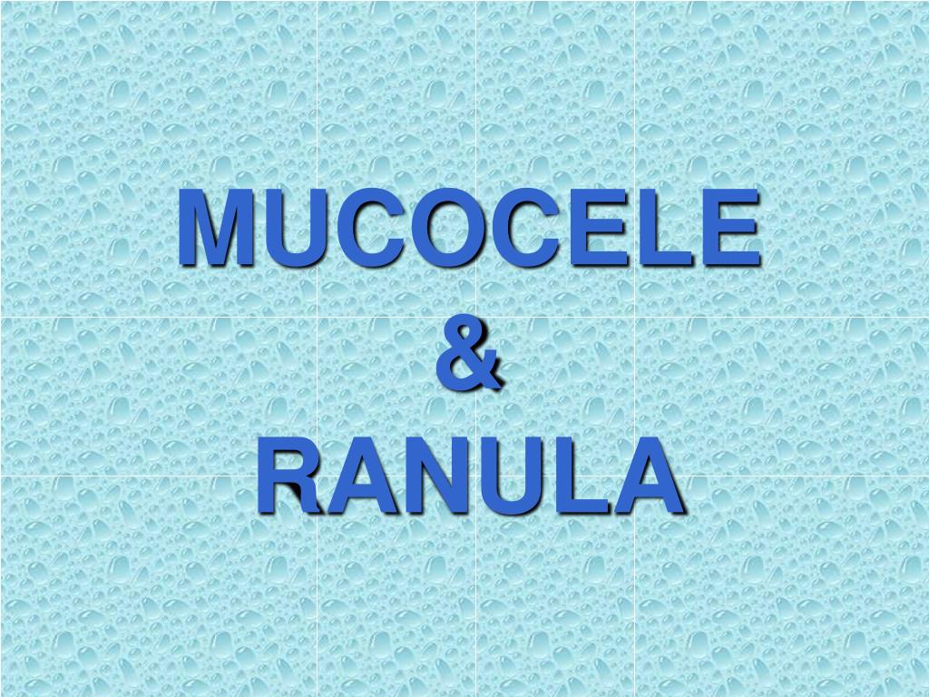 PPT - MUCOCELE & RANULA PowerPoint Presentation, free download - ID:1067382