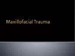PPT - Maxillofacial Trauma PowerPoint Presentation, free download - ID ...