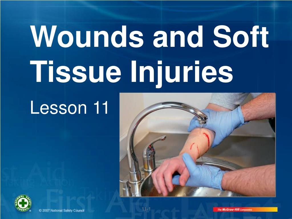 PPT - Essential First Aid for Wounds and Soft Tissue Injuries ...