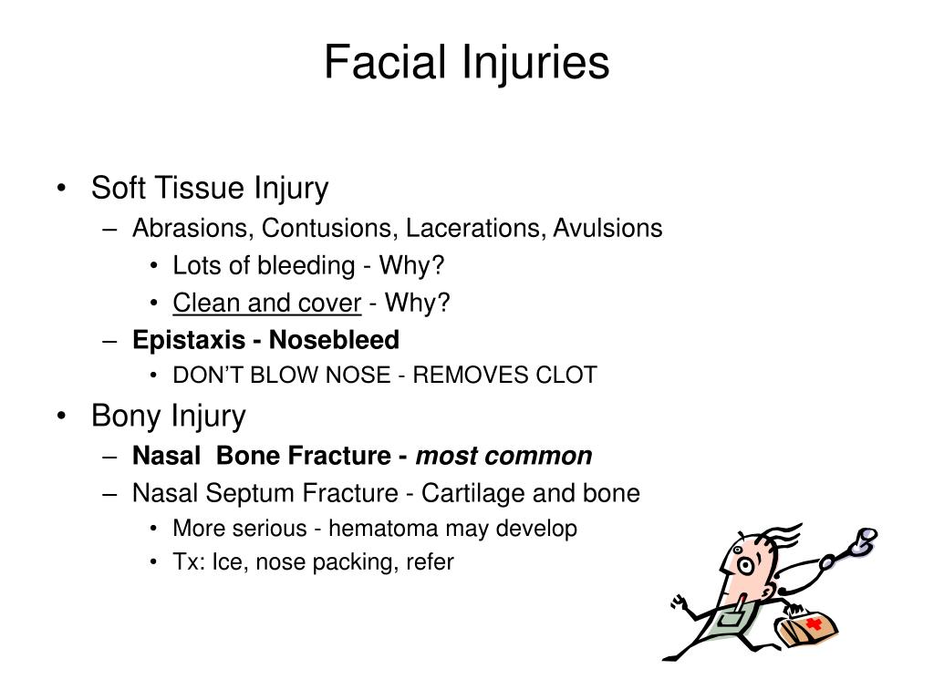 PPT - Facial Injuries PowerPoint Presentation, free download - ID:1094947