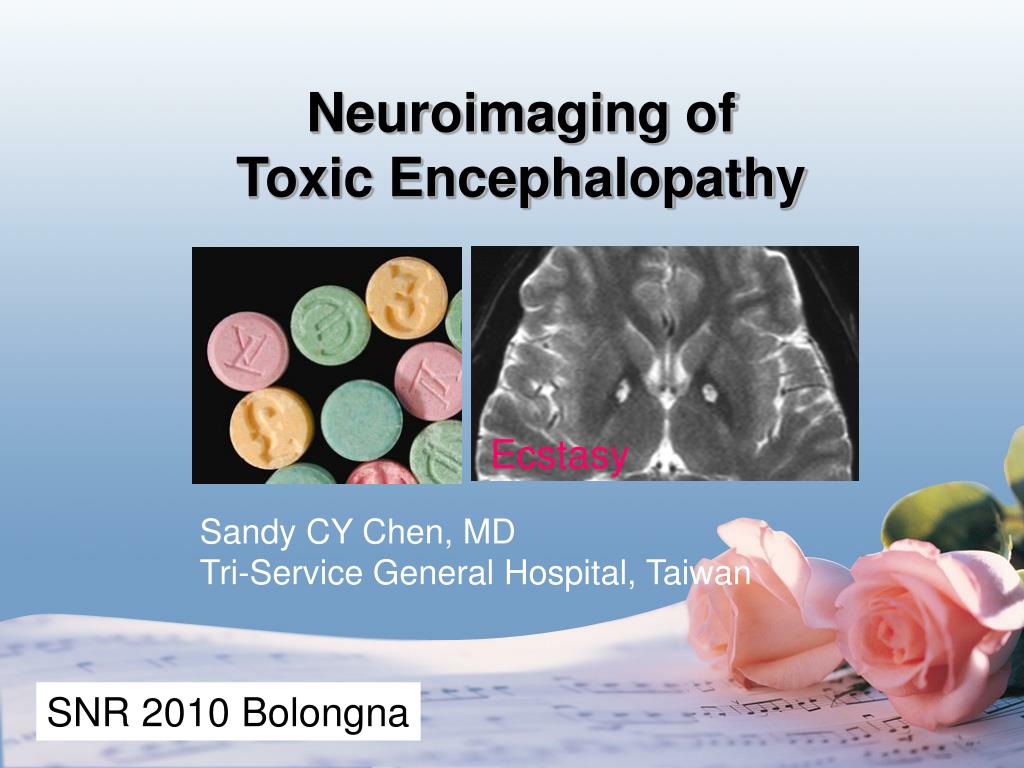 PPT - Neuroimaging of Toxic Encephalopathy PowerPoint Presentation ...