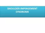 PPT - Impingement Syndrome PowerPoint Presentation, free download - ID ...