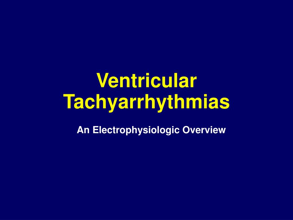 PPT - Ventricular Tachyarrhythmias PowerPoint Presentation, free ...