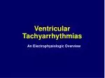 PPT - Ventricular Tachyarrhythmias PowerPoint Presentation, free ...