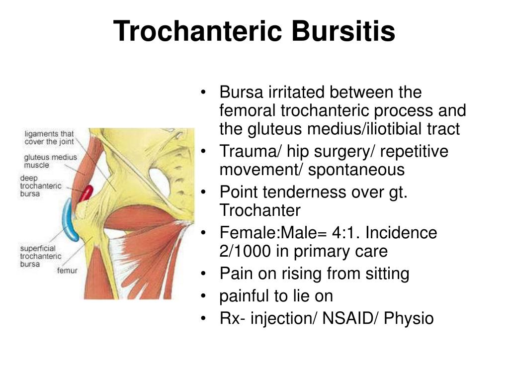 PPT - Trochanteric Bursitis PowerPoint Presentation, free download - ID ...