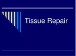 PPT - Tissue Repair PowerPoint Presentation, free download - ID:2090791