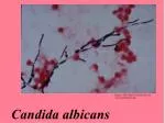 PPT - Gram Stain of a Clinical Specimen of Candida albicans PowerPoint ...