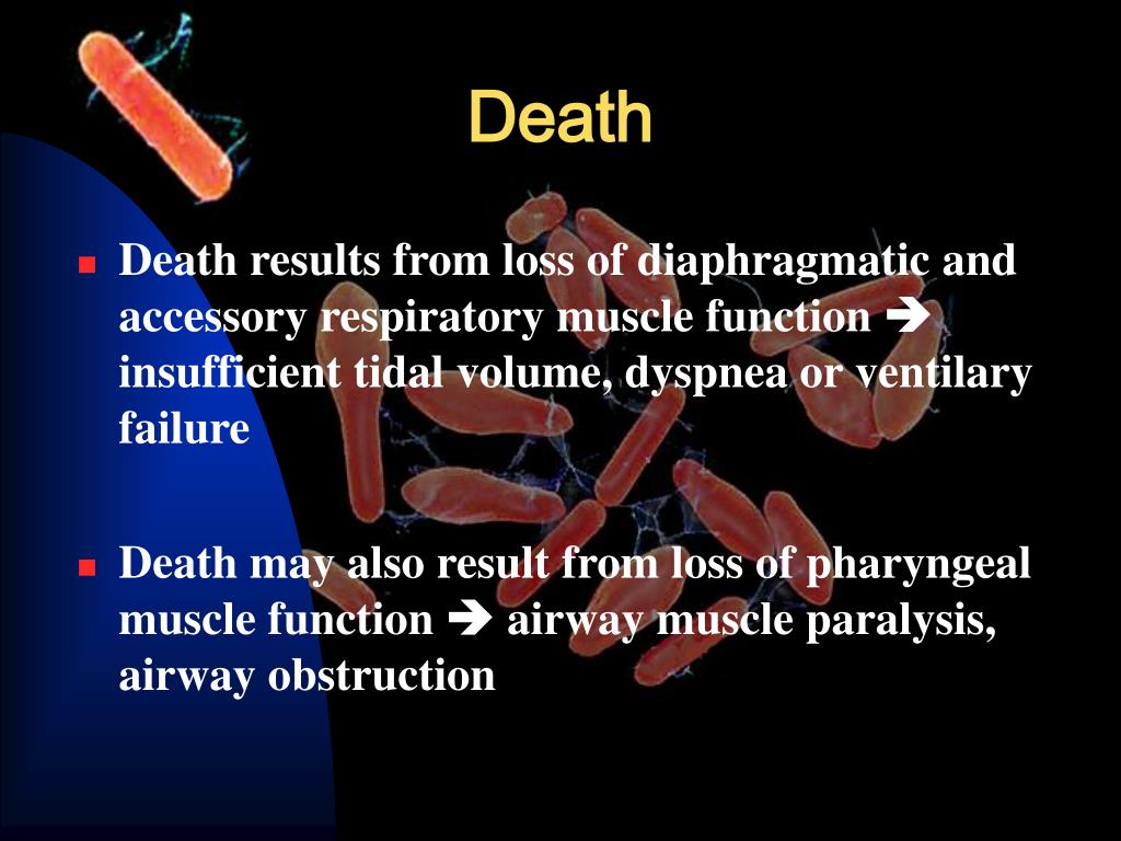 PPT - Death PowerPoint Presentation, free download - ID:1221372