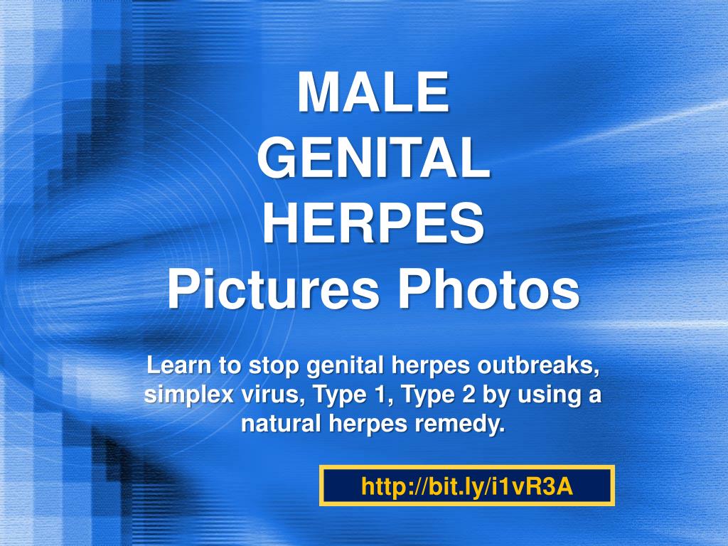 PPT - male genital herpes remedy pictures photos PowerPoint ...