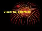 PPT - Visual Field Examinations PowerPoint Presentation, free download ...