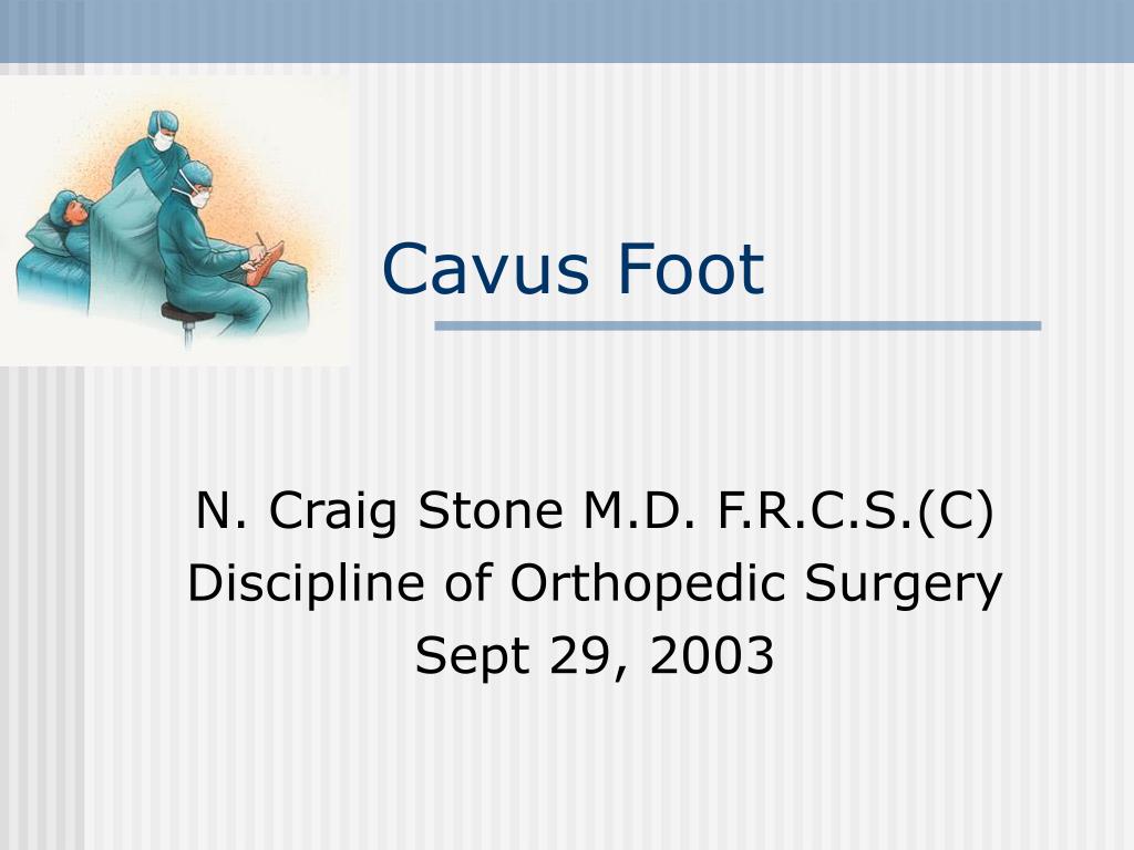 PPT - Cavus Foot PowerPoint Presentation, free download - ID:1273571