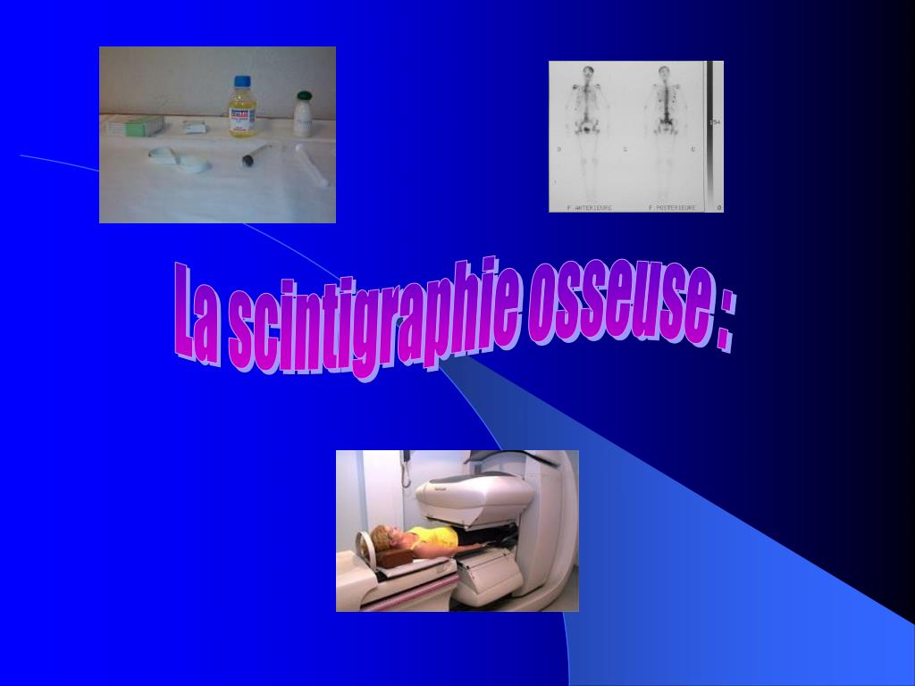 PPT - La scintigraphie osseuse : PowerPoint Presentation, free download ...