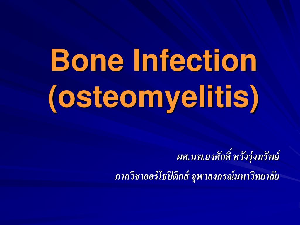 PPT - Bone Infection (osteomyelitis) PowerPoint Presentation, free ...