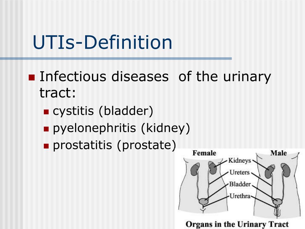 PPT - UTIs-Definition PowerPoint Presentation, free download - ID:1287310