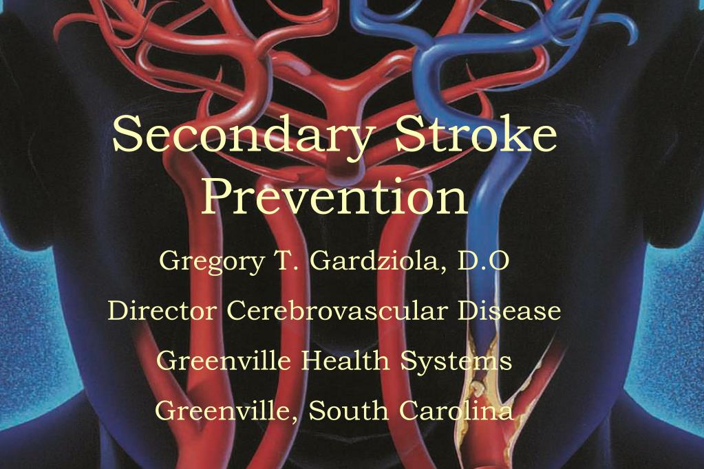 PPT - Brain Attack! PowerPoint Presentation, free download - ID:1321330