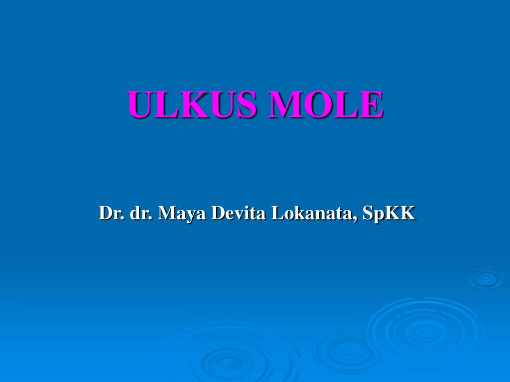 PPT - ULKUS MOLE PowerPoint Presentation, free download - ID:1336992