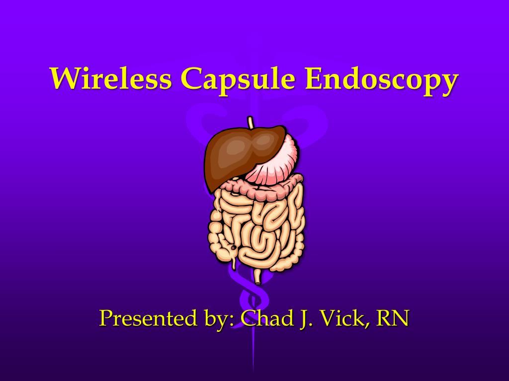 PPT - Wireless Capsule Endoscopy PowerPoint Presentation, free download ...