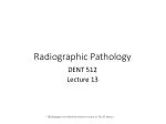 PPT - RADIOGRAPHIC TESTING PowerPoint Presentation, free download - ID ...