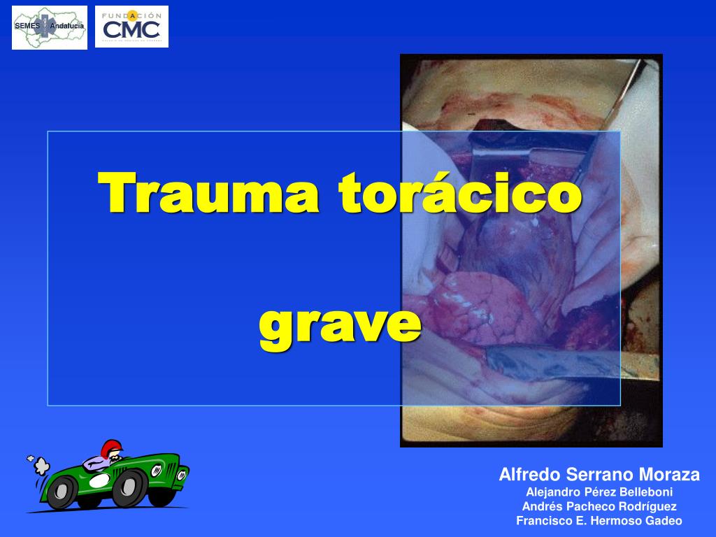 PPT - Trauma torácico grave PowerPoint Presentation, free download - ID ...