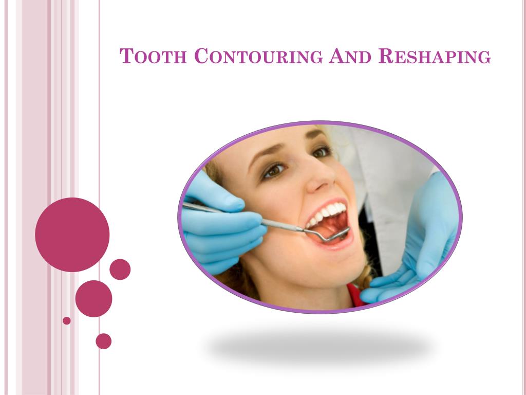 PPT - tooth contouring and reshaping PowerPoint Presentation, free ...