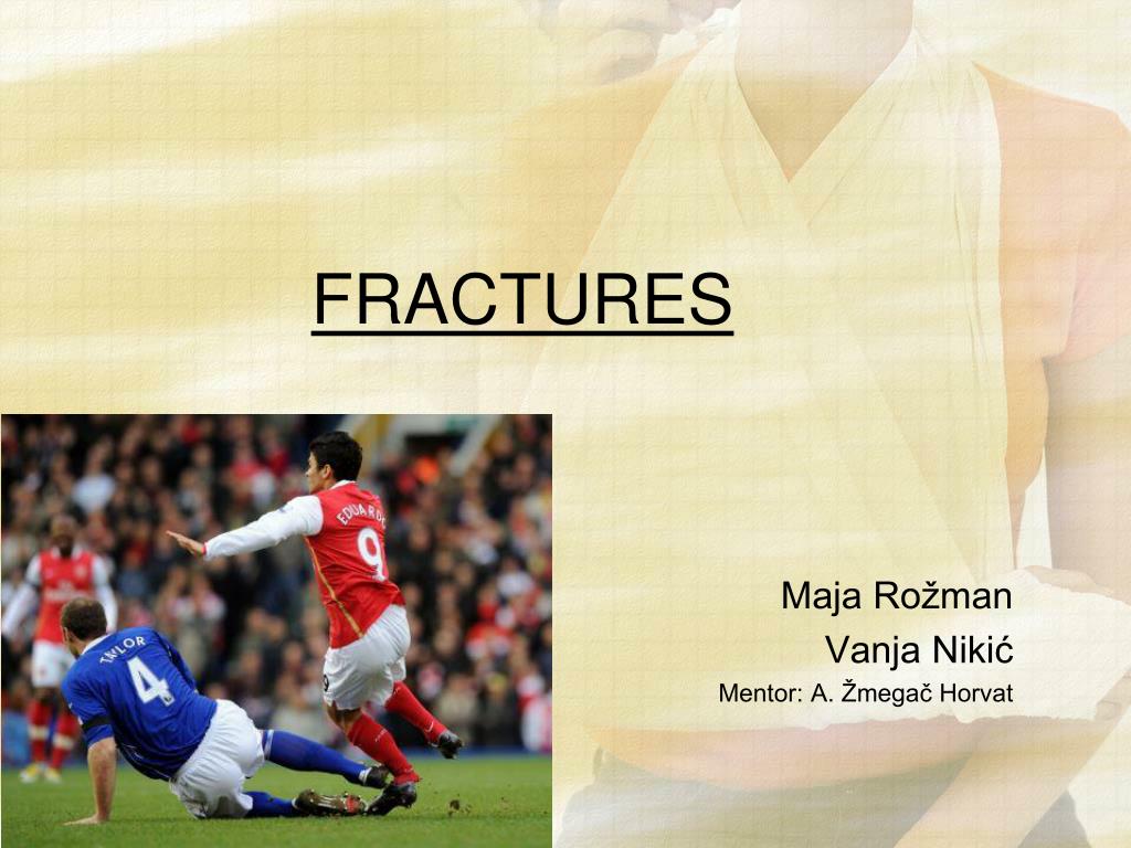 PPT - FRACTURES PowerPoint Presentation, free download - ID:1397160