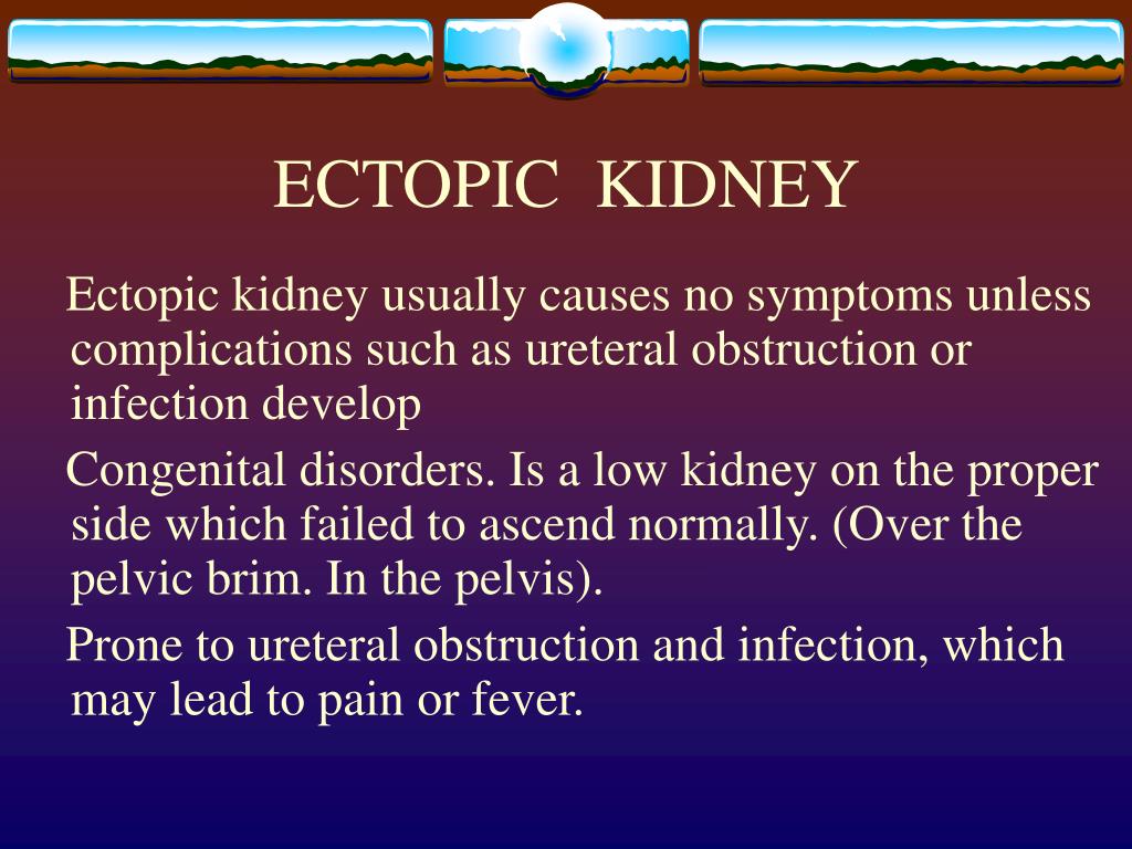 PPT - ECTOPIC KIDNEY PowerPoint Presentation, free download - ID:144224