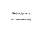 PPT - Retinoblastoma PowerPoint Presentation, free download - ID:5637636