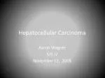 PPT - Diagnosis and Treatment of Hepatocellular carcinoma PowerPoint ...