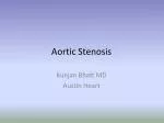 PPT - AORTIC STENOSIS PowerPoint Presentation, free download - ID:1193838