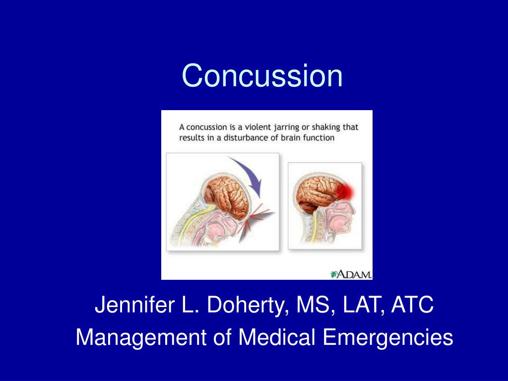 PPT - Concussion PowerPoint Presentation, free download - ID:162941