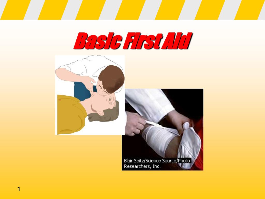 PPT - Basic First Aid PowerPoint Presentation, free download - ID:165345