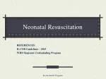 PPT - Neonatal Apnea PowerPoint Presentation, free download - ID:5406187