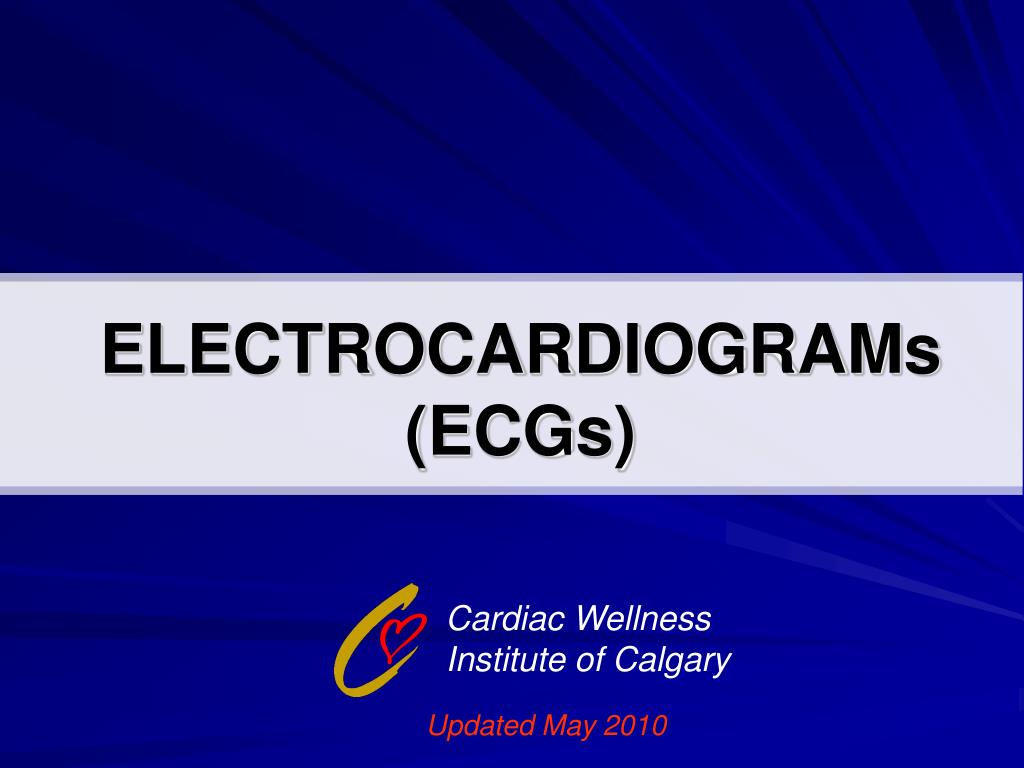 PPT - ELECTROCARDIOGRAMs (ECGs) PowerPoint Presentation, free download ...