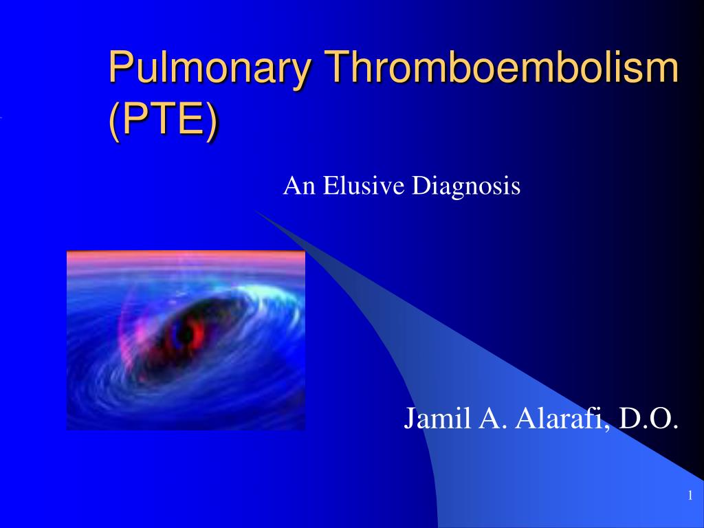 PPT - Pulmonary Thromboembolism (PTE) PowerPoint Presentation, free ...