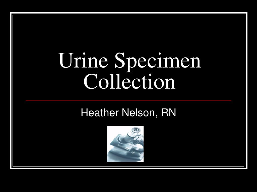 PPT - Urine Specimen Collection PowerPoint Presentation, free download - ID:210917