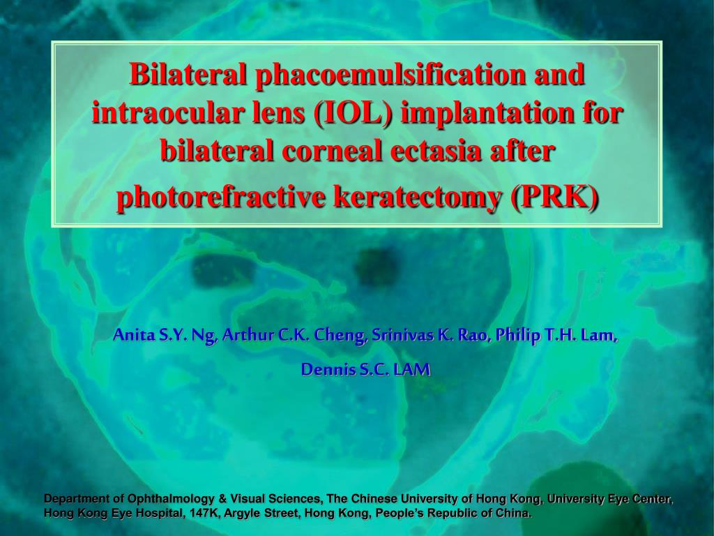 PPT - Bilateral phacoemulsification and intraocular lens (IOL ...