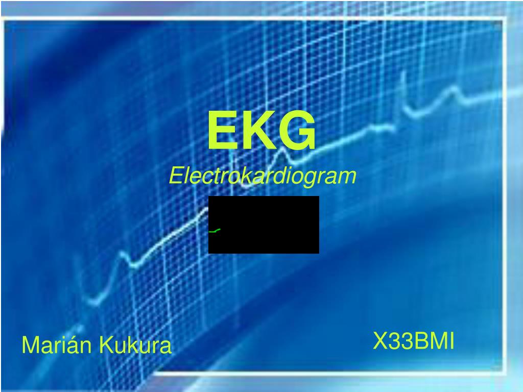 PPT - EKG Electrokardiogram PowerPoint Presentation, free download - ID ...