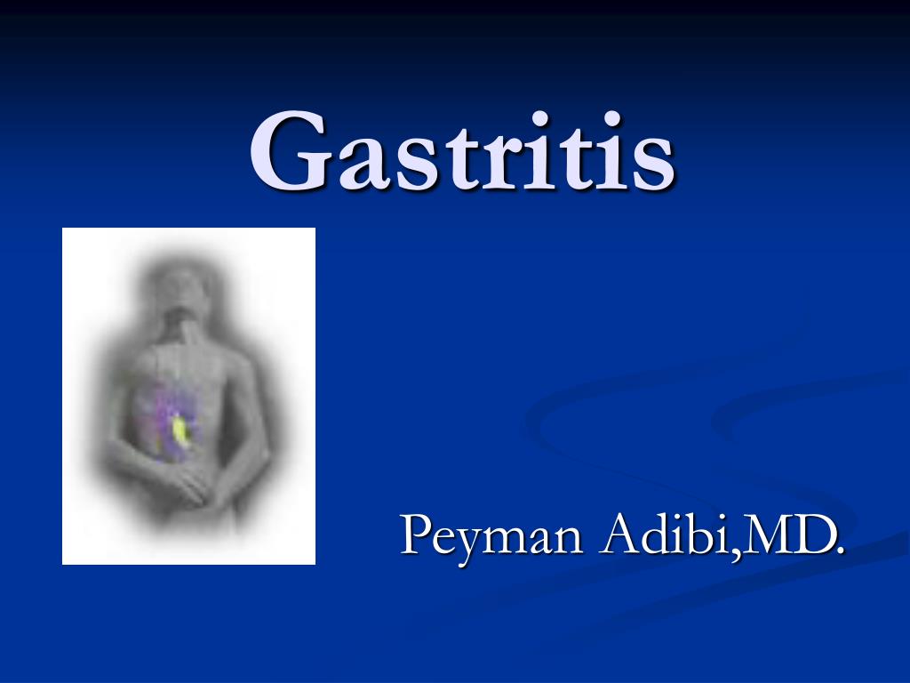 PPT - Gastritis PowerPoint Presentation, free download - ID:228190