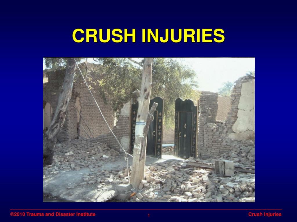 PPT - CRUSH INJURIES PowerPoint Presentation, free download - ID:22957