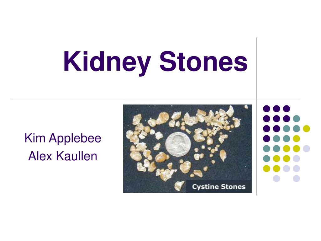 PPT - Kidney Stones PowerPoint Presentation, free download - ID:23768