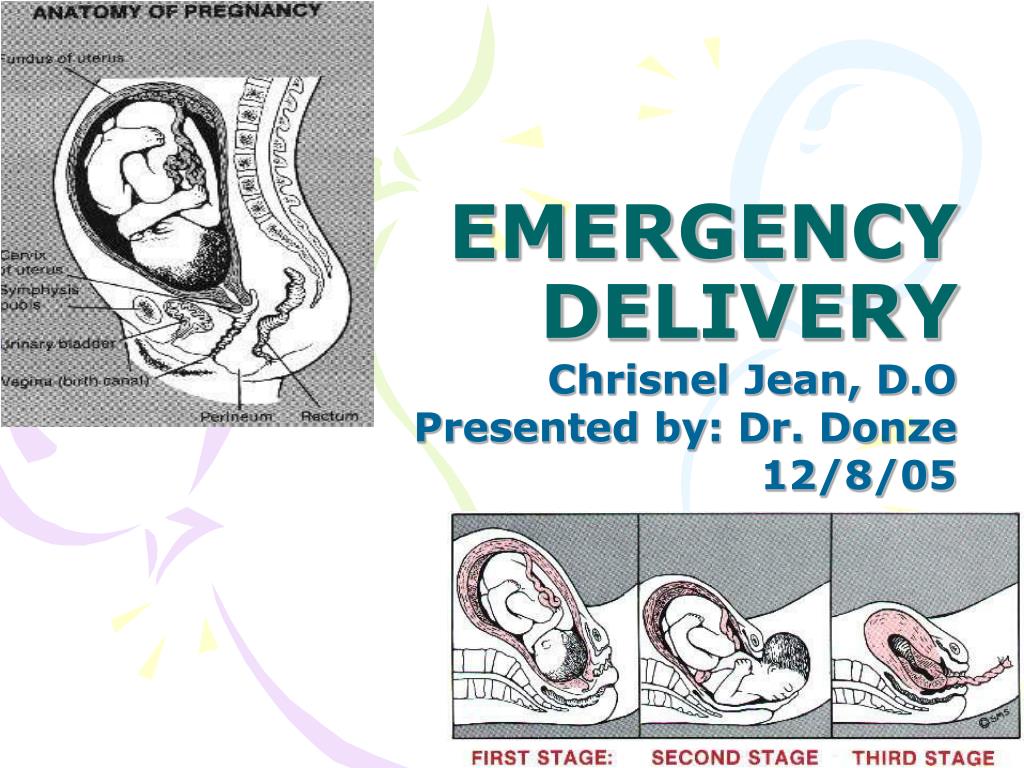 PPT - EMERGENCY DELIVERY PowerPoint Presentation, free download - ID:245779