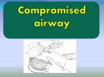 PPT - AIRWAY OBSTRUCTIONS PowerPoint Presentation, free download - ID ...