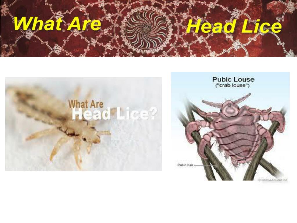 PPT - What Are Head Lice PowerPoint Presentation, free download - ID:265308