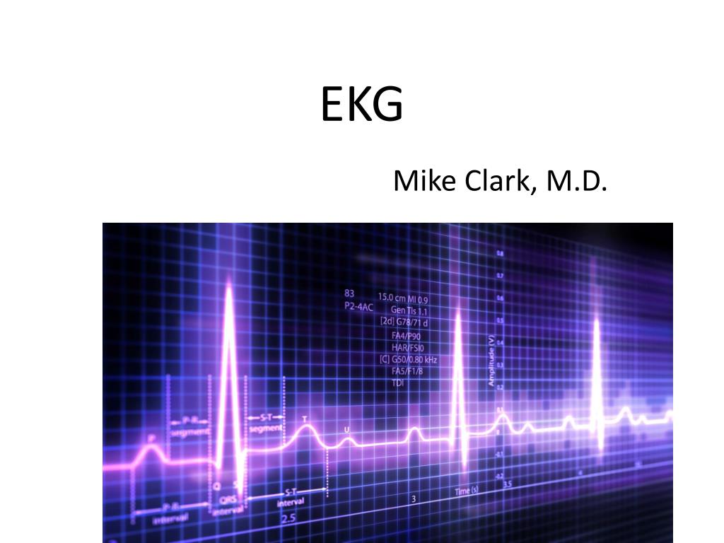 PPT - EKG PowerPoint Presentation, free download - ID:296817