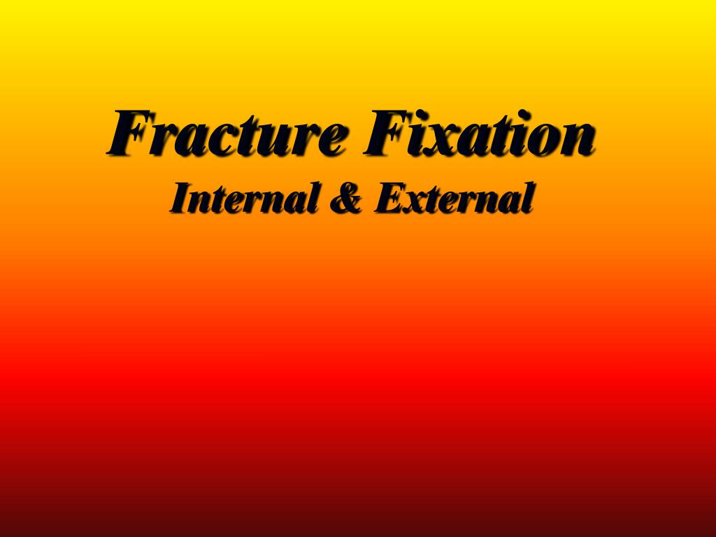 PPT - Fracture Fixation Internal & External PowerPoint Presentation ...